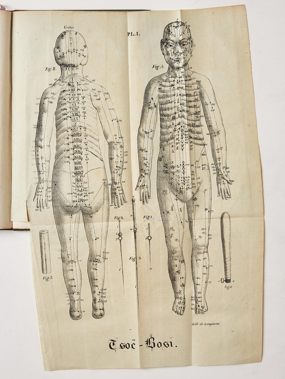 EARLY HISTORY OF ELECTRO-ACUPUNCTURE, Paris 1825. Books, Maps ...