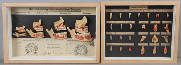 WATCH CABINET, 2 pcs. wax training models for dentists. Miscellaneous ...
