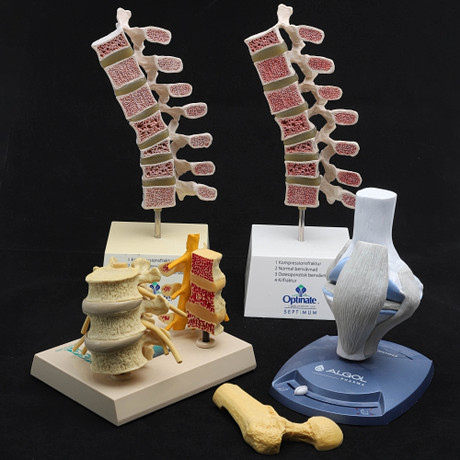 ANATOMICAL MODELS. 4 pieces. Tagged Fosamax, Optinate and Donacom ...