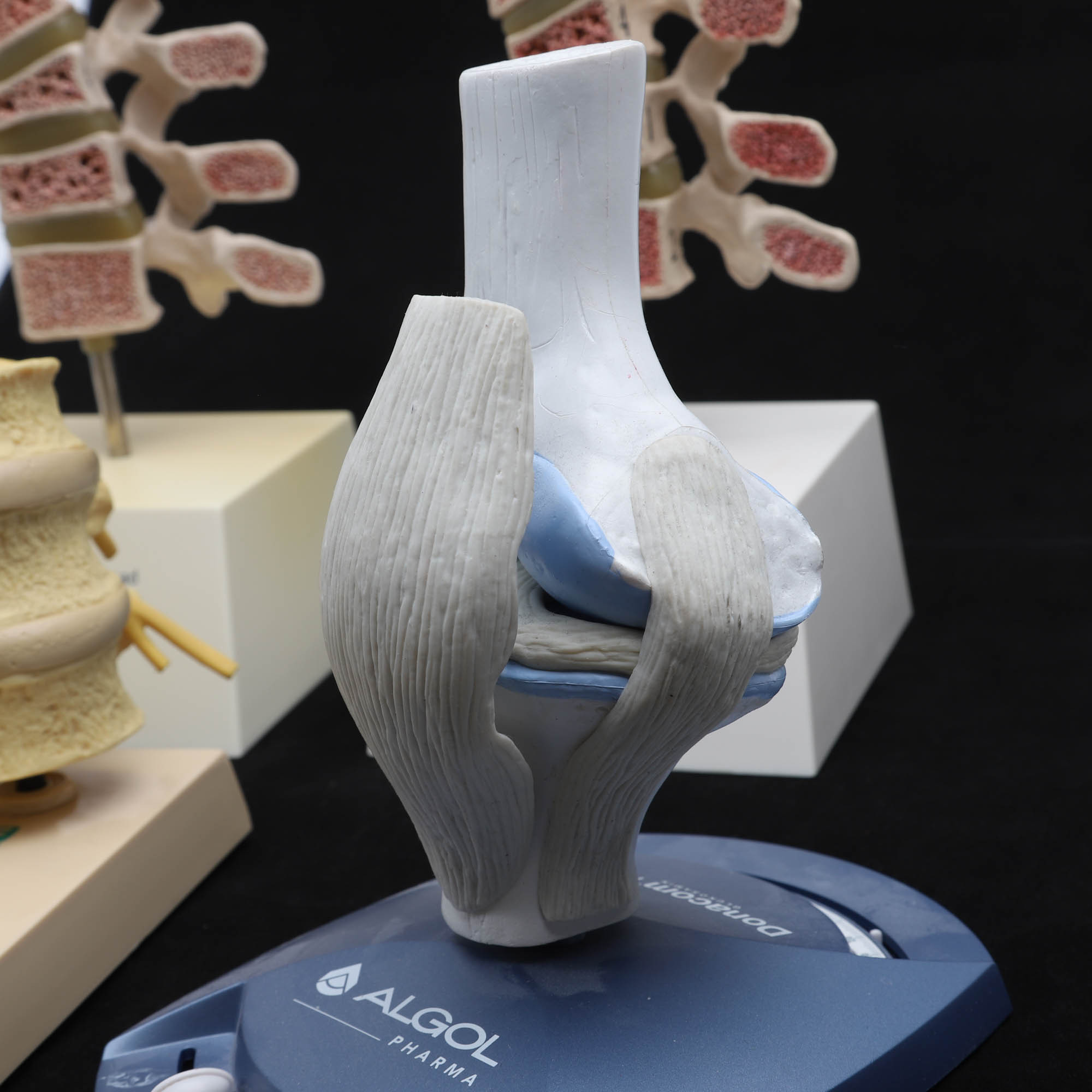 Images for 3634933. ANATOMICAL MODELS. 4 pieces. Tagged Fosamax ...