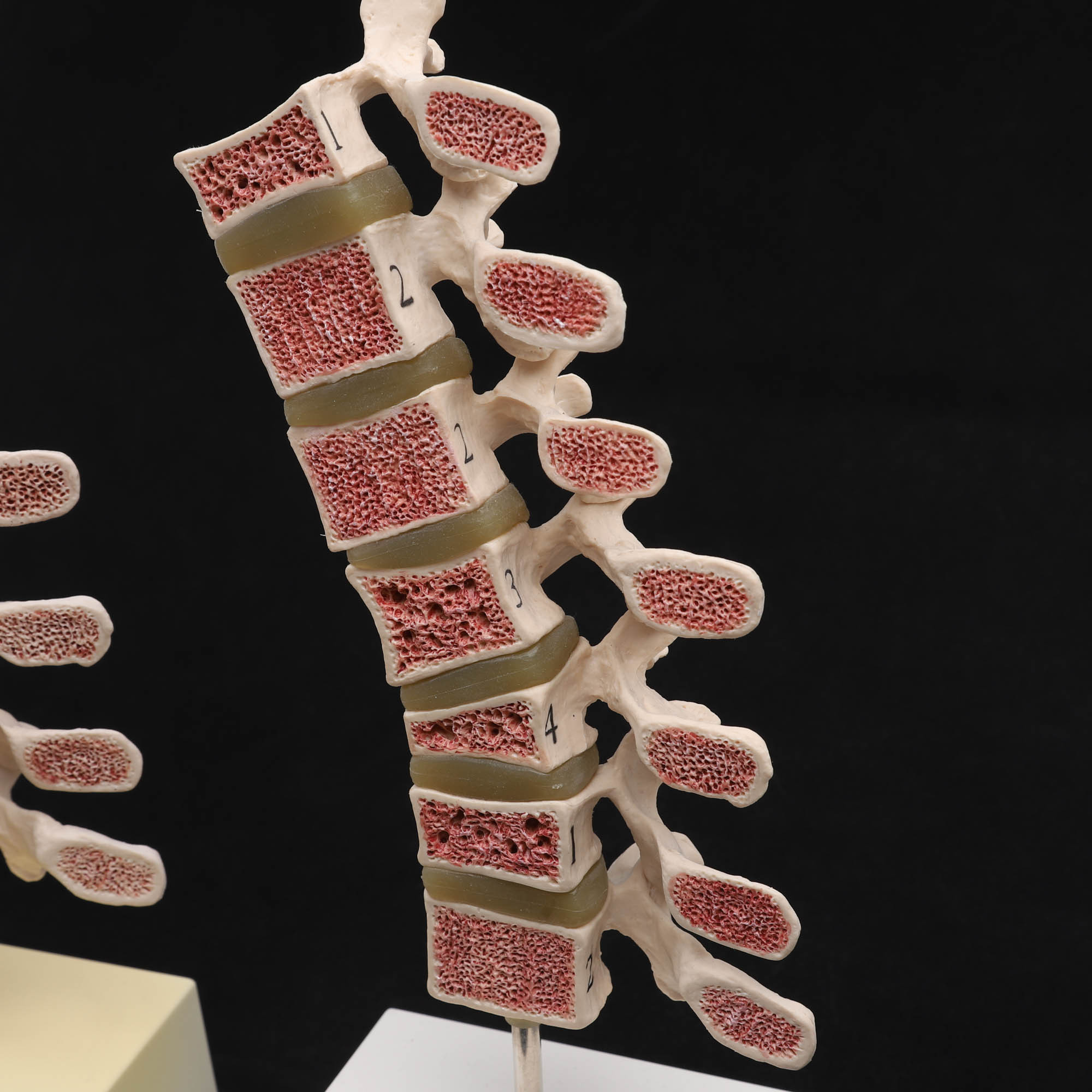 Images for 3634933. ANATOMICAL MODELS. 4 pieces. Tagged Fosamax ...